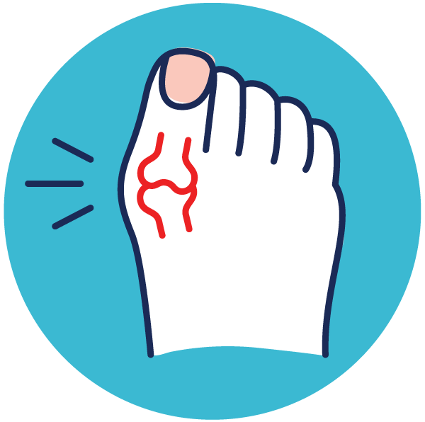 Toe-Cushioning Compression Socks for Running – Toe Bumpers